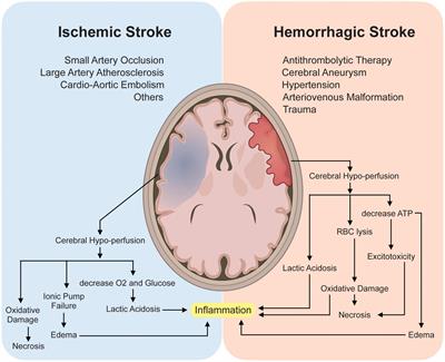 Frontiers | Advancement of epigenetics in stroke